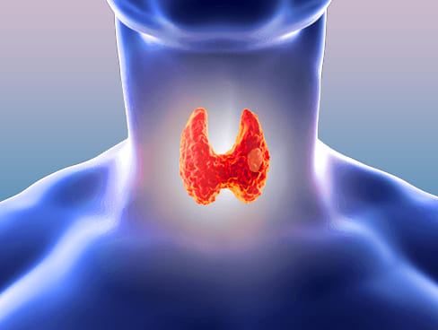 Folliküler Tiroid Kanseri